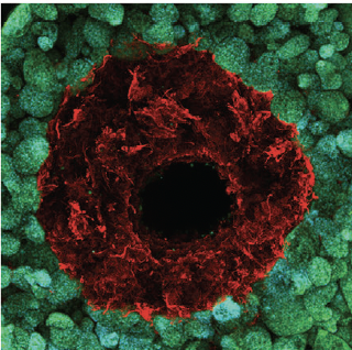 Embedding Biomimetic Vascular Networks via Coaxial Sacrificial Writing ...