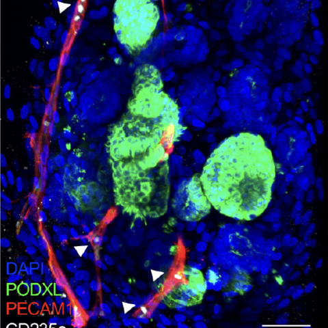 A Perfusable, Vascularized Kidney Organoid-on-Chip Model | Lewis Lab